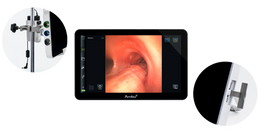 Ambu aView 2 Advance Gen. 2 | Patient Monitor